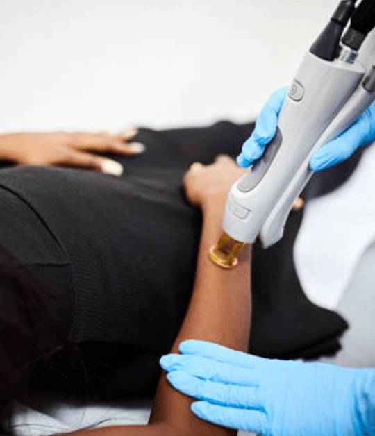 Laser Hair Removal - Laser & Beauty Aesthetics by Shiela