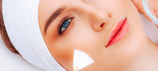 Skin Peels - Laser & Beauty Aesthetics by Shiela