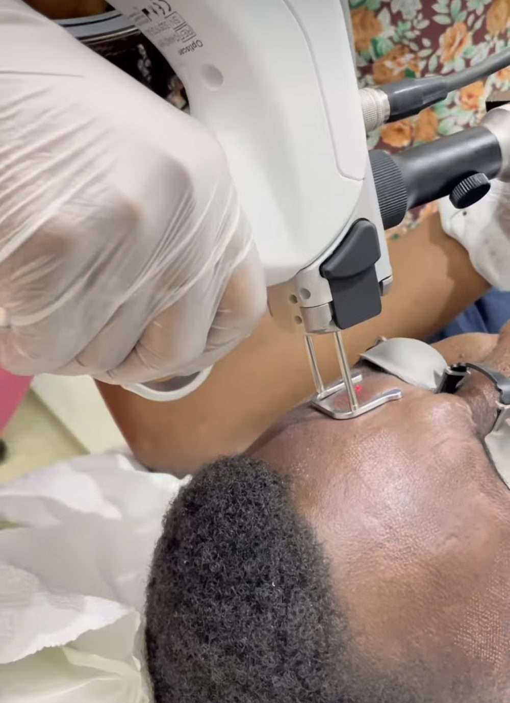 Co2 Laser Treatment - Laser & Beauty Aesthetics by Shiela